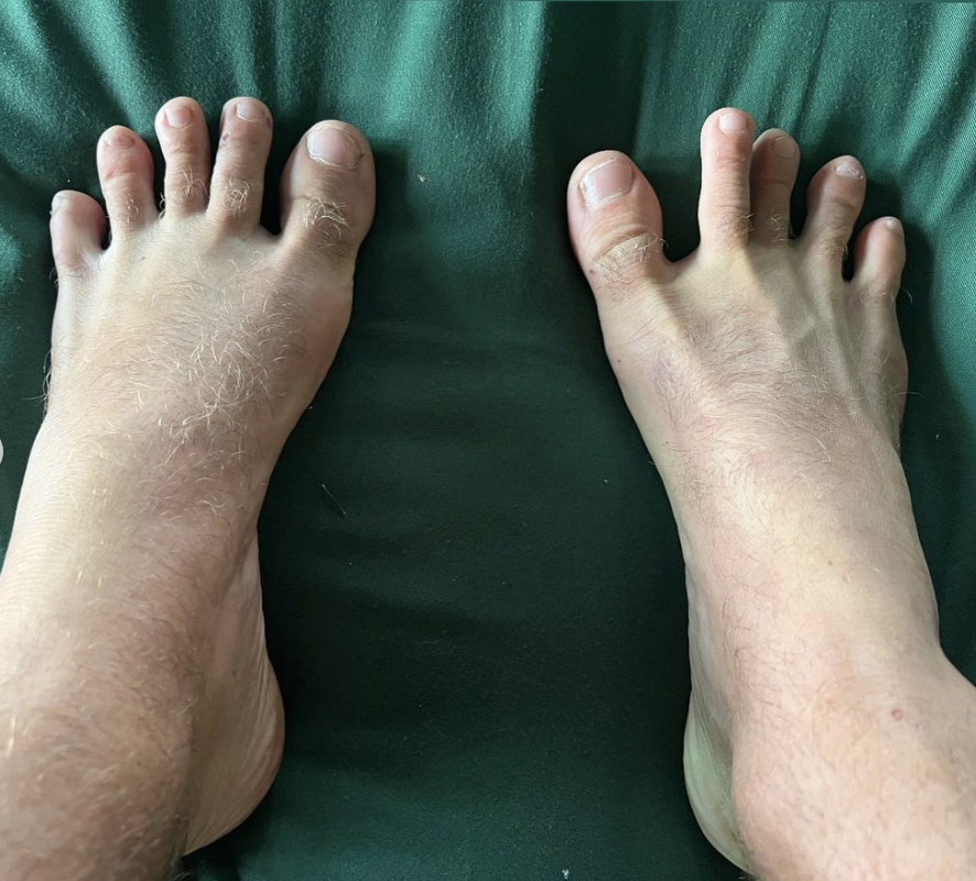 North Shore Heavyweights Unite To Arouse Toe Lovers - Stab Mag