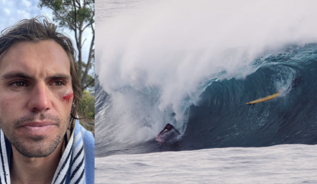 How Kipp Caddy Got KO'd + Tore His Hamstring Paddling An Outer-Reef ...